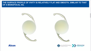 What Sets the Vivity IOL Apart from Other Premium Lenses? | Loden ...