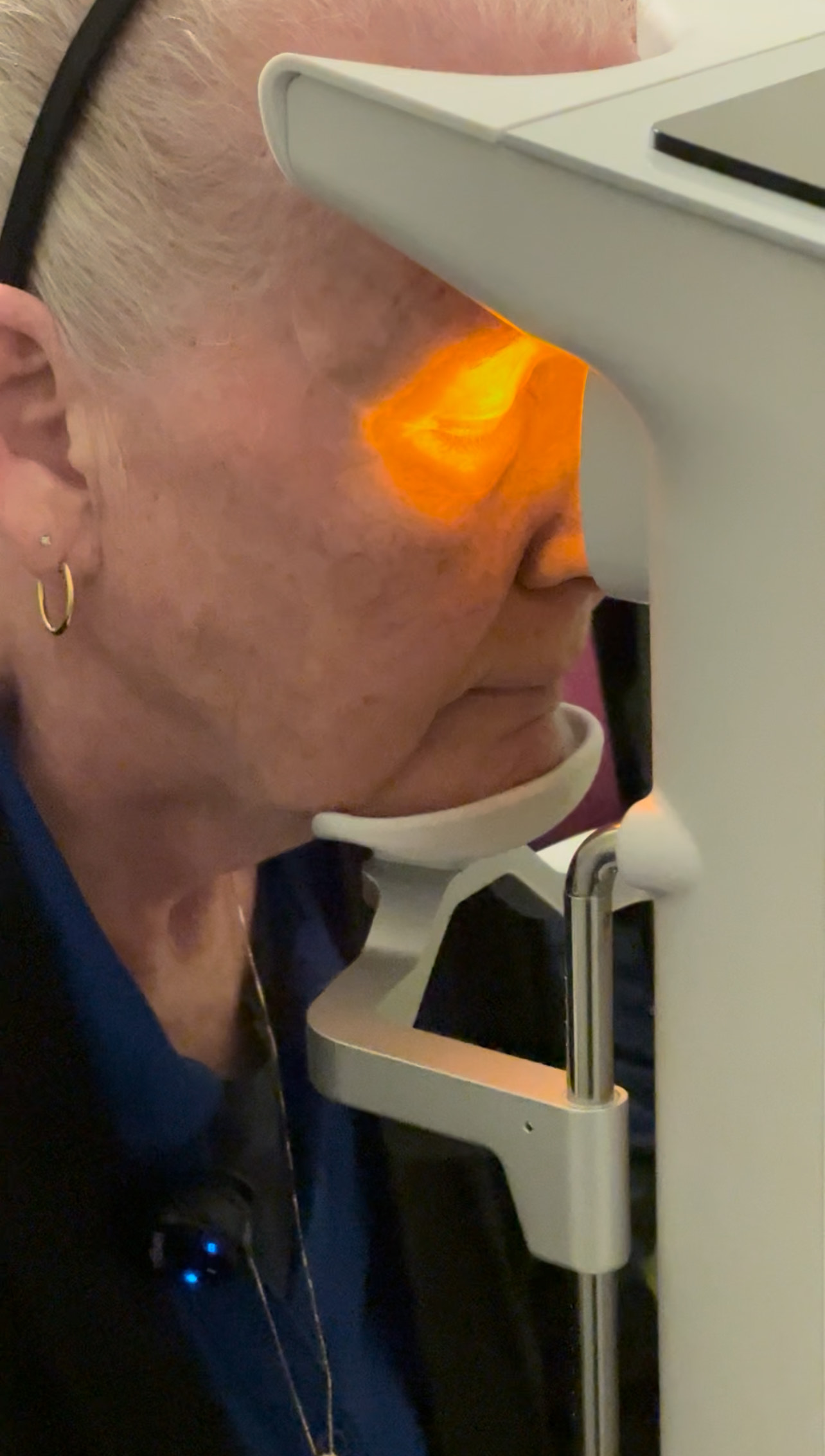 How Does Valeda Treat Dry Age-Related Macular Degeneration? | Loden Vision