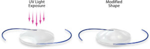 What to Know About the Light Adjustable Lens | Loden Vision