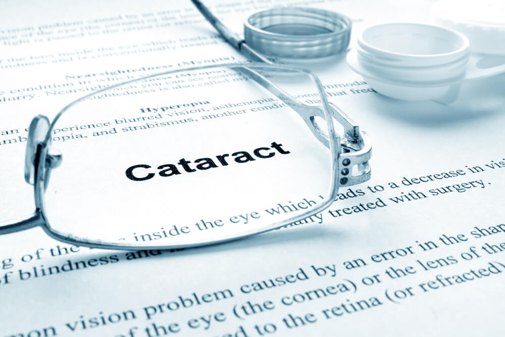 6 Common Cataract Risk Factors | Cataract Treatment Paris TN